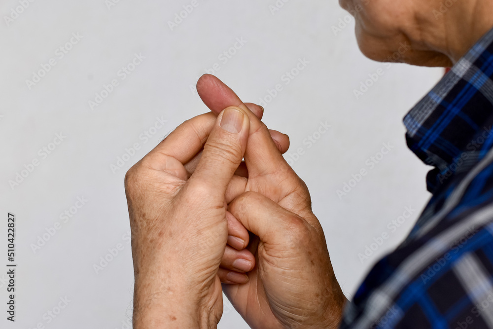 Foto de Stock Pain in fingertip of Asian man. Concept of cellulitis and ...