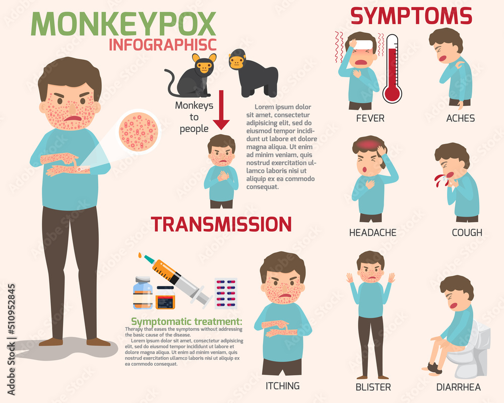 Monkeypox virus infographics elements, Human body with rash. Symptoms ...
