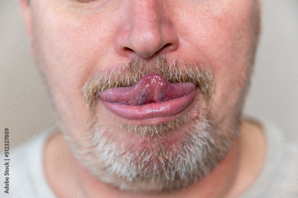 Lower part of male face. Mature man with stubble trying to reach his ...