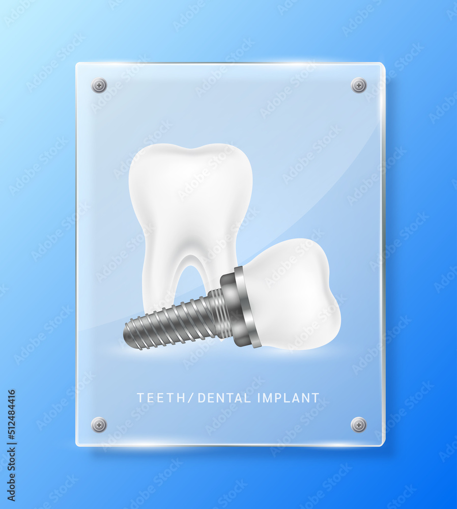 Tooth and Dental implant inside square translucent glass panels for ...