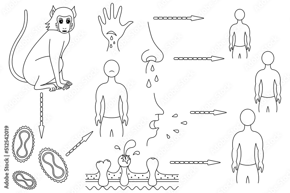 Vector de Stock Monkeypox. The route of infection and the mechanism of ...