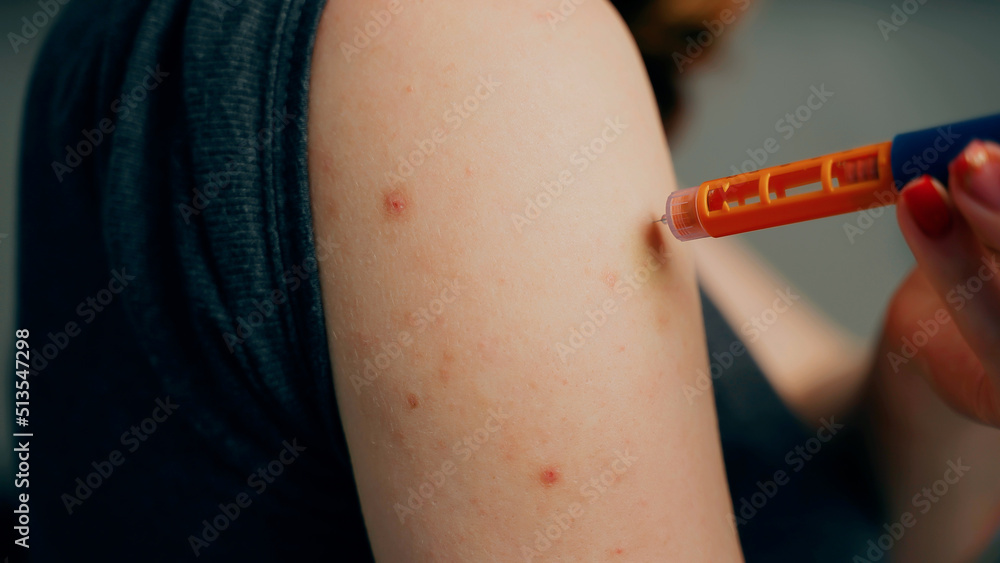 Woman diabetic giving insulin injection into shoulder using insulin pen ...