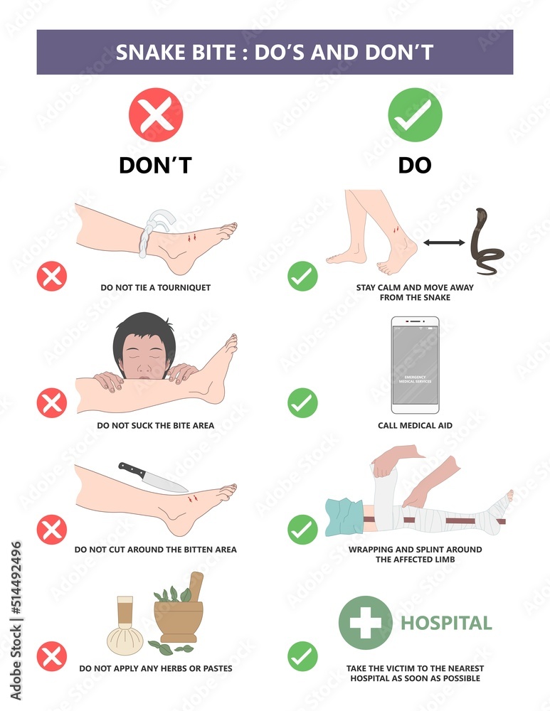 Snake Bite First Aid care non venomous anti venom serum hand leg king ...