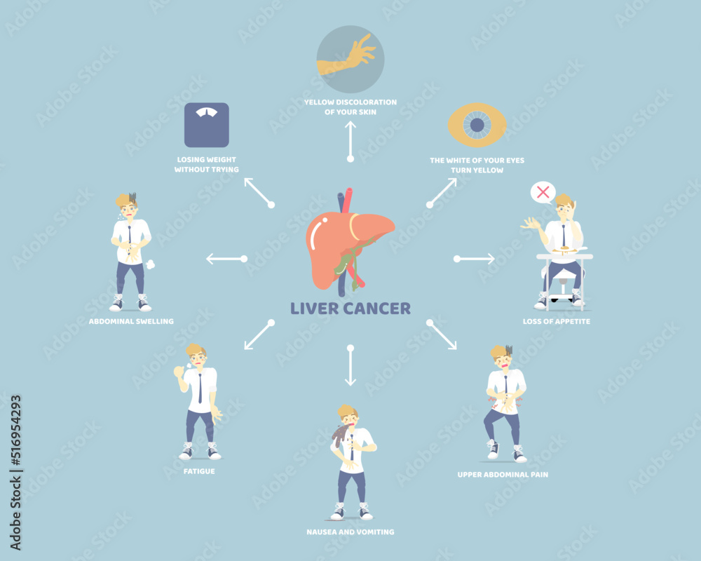 liver cancer and anatomy, health care, liver disease infographic ...