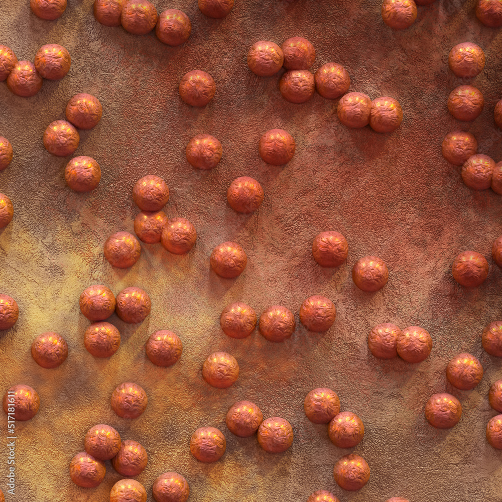 Medical background, Staphylococcus aureus, a type of spherical gram ...