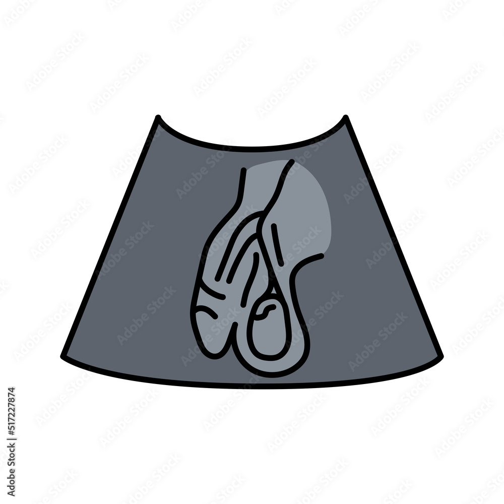 Ultrasound male reproductive system color line illustration Stock ...
