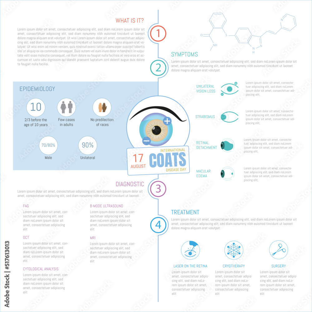 International Coats Disease Day.Infographic ,eye with indication of ...
