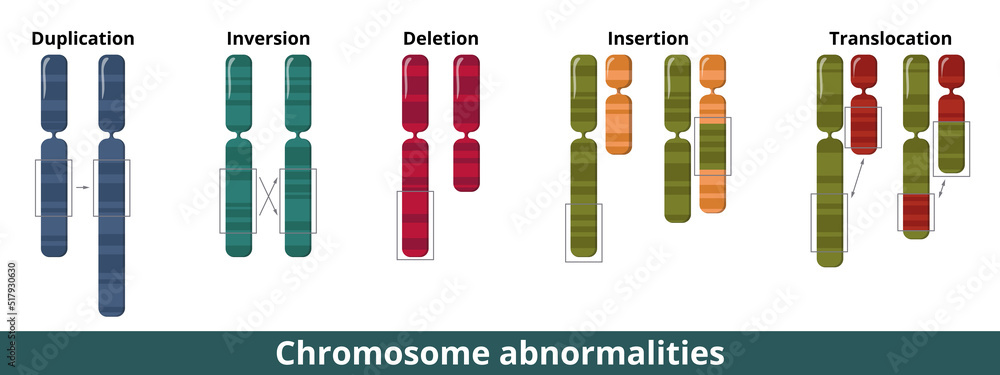 Image vectorielle Stock Chromosome abnormalities. Visualization of ... Image vectorielle Stock Chromosome abnormalities. Visualization of ...