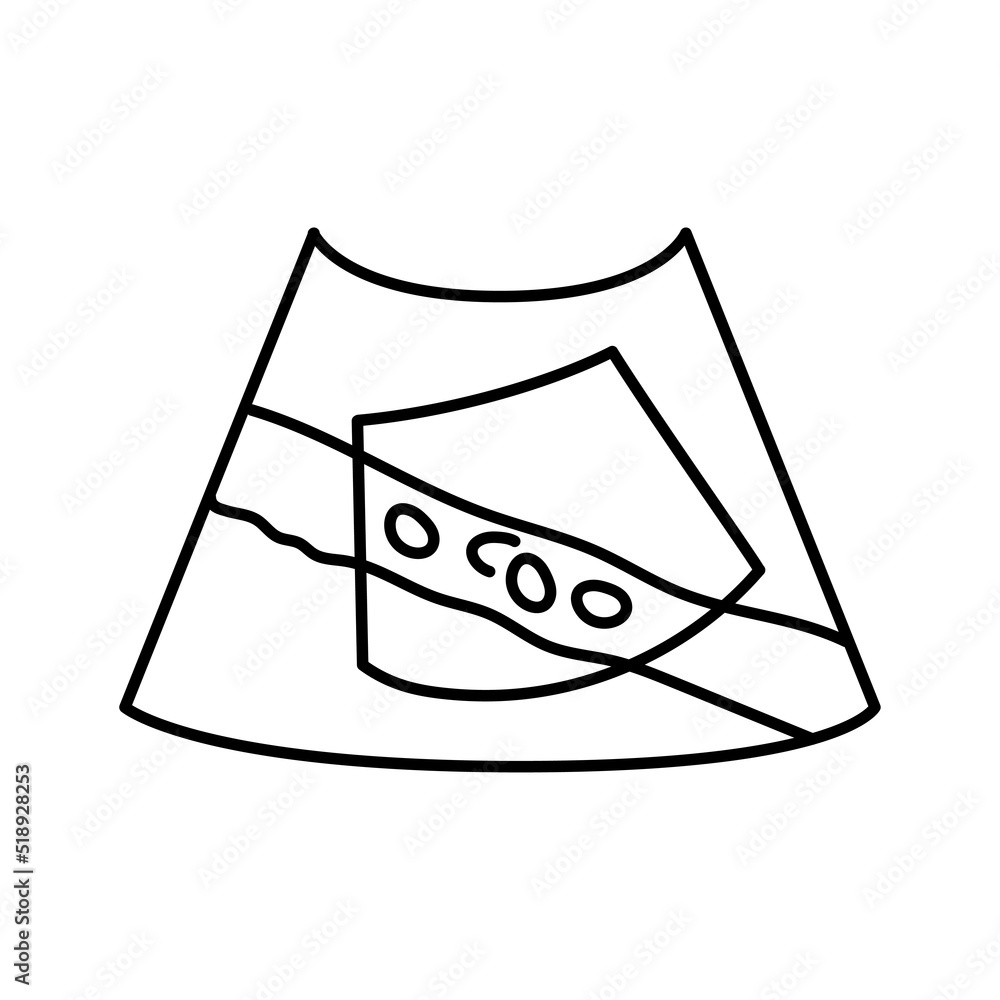 Ultrasound hemodynamics blood circulation color line illustration Stock ...