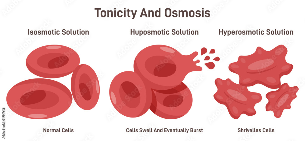 Tonicity as osmosis of the blood cells. Hypertonic, isotonic, hypotonic ...