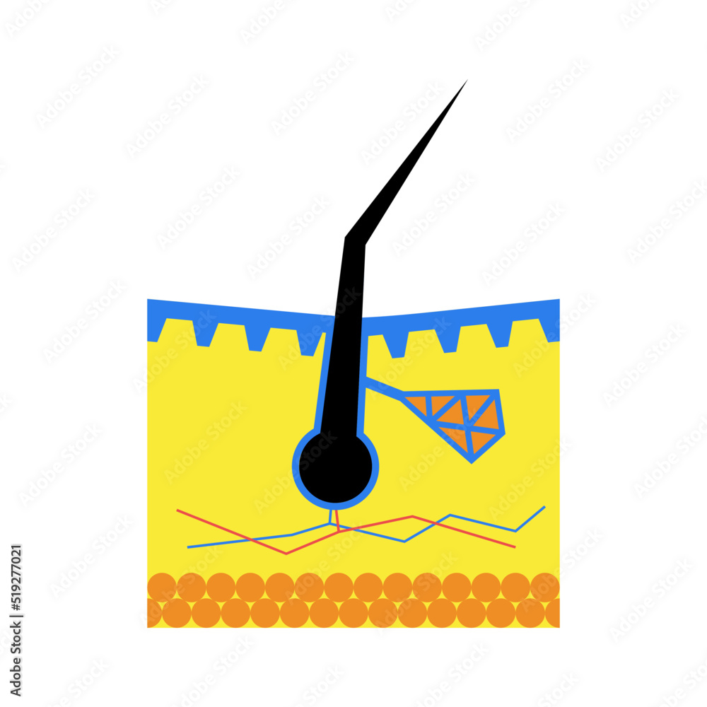 Medical education chart for skin cross section. Hair follicle ...