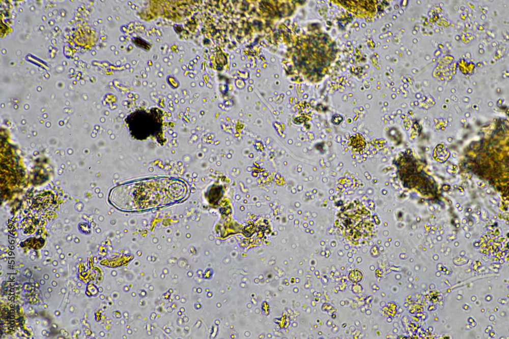 soil microbes organisms in a soil and compost sample, testate amoebae ...