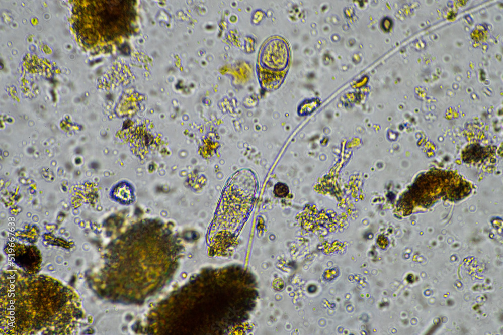 Stock-Foto „soil microbes organisms in a soil and compost sample ...