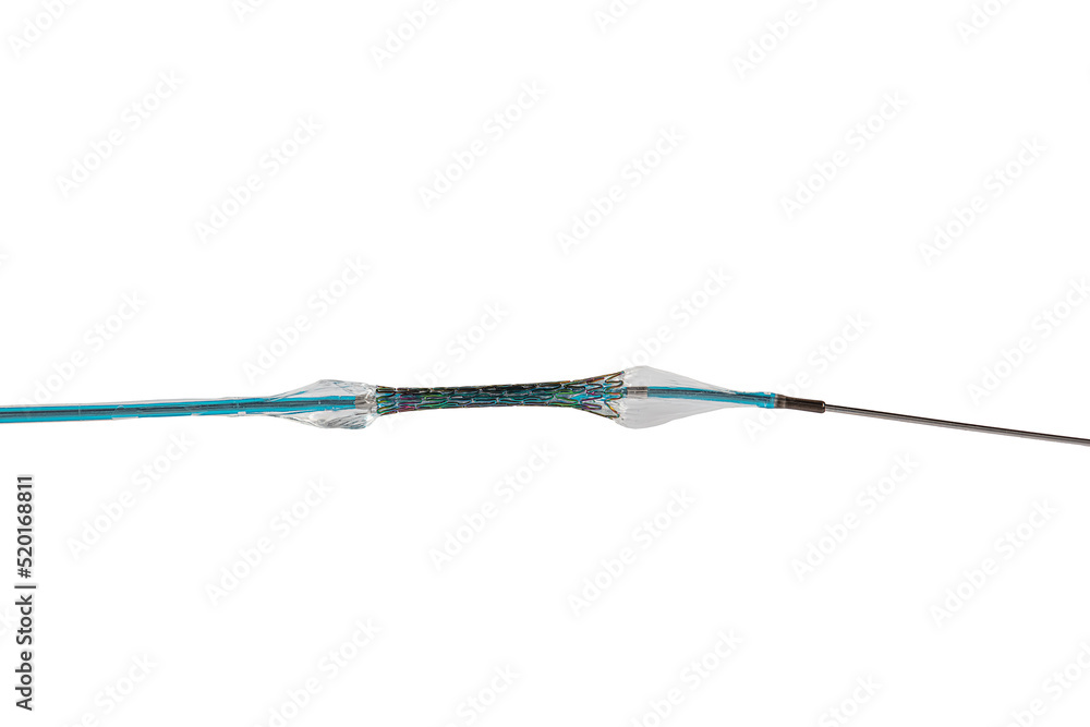 Heart Stent angioplasty. Stent and catheter for implantation into blood ...