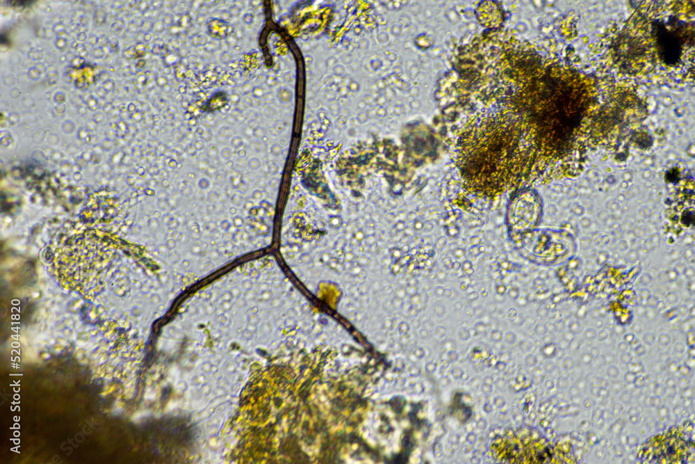 soil microbes organisms in a soil and compost sample, fungus and fungi ...