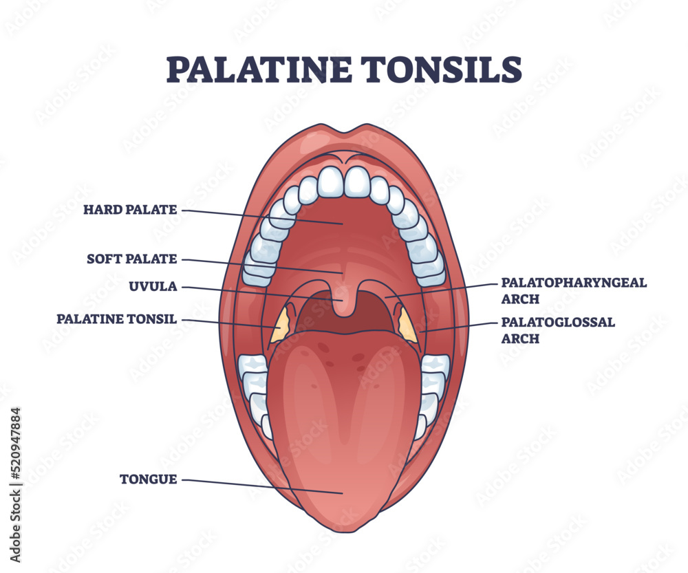 Stock-Vektorgrafik „Palatine tonsils organ location behind throat and ...
