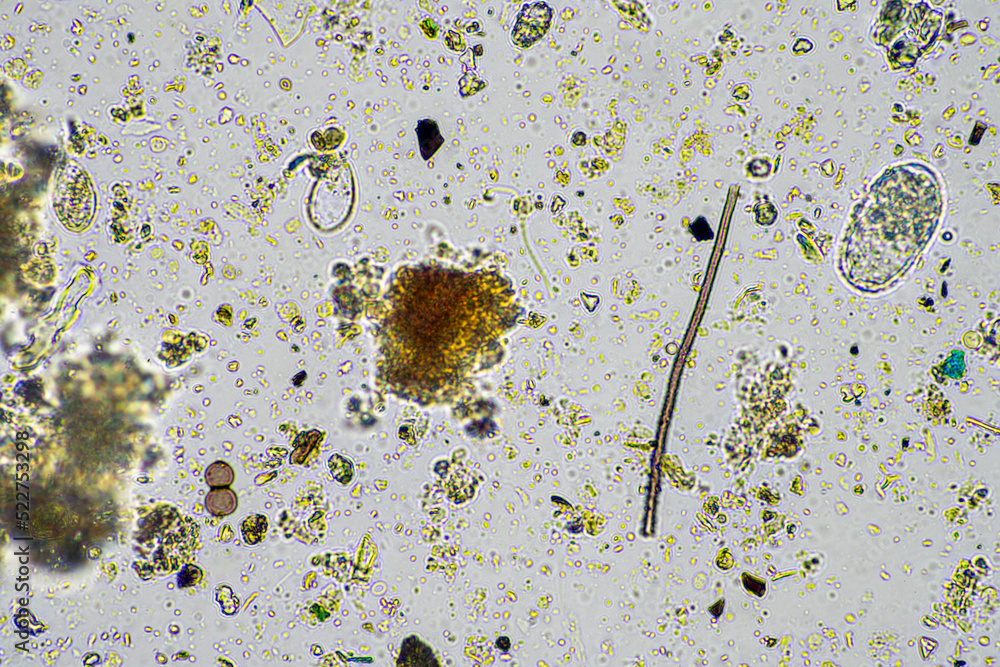 soil microbes organisms in a soil and compost sample, fungus and fungi ...
