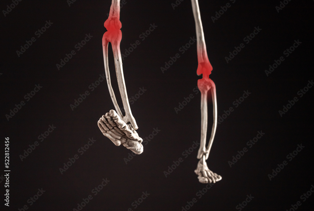 Human skeleton legs with painful knees with red point on black ...