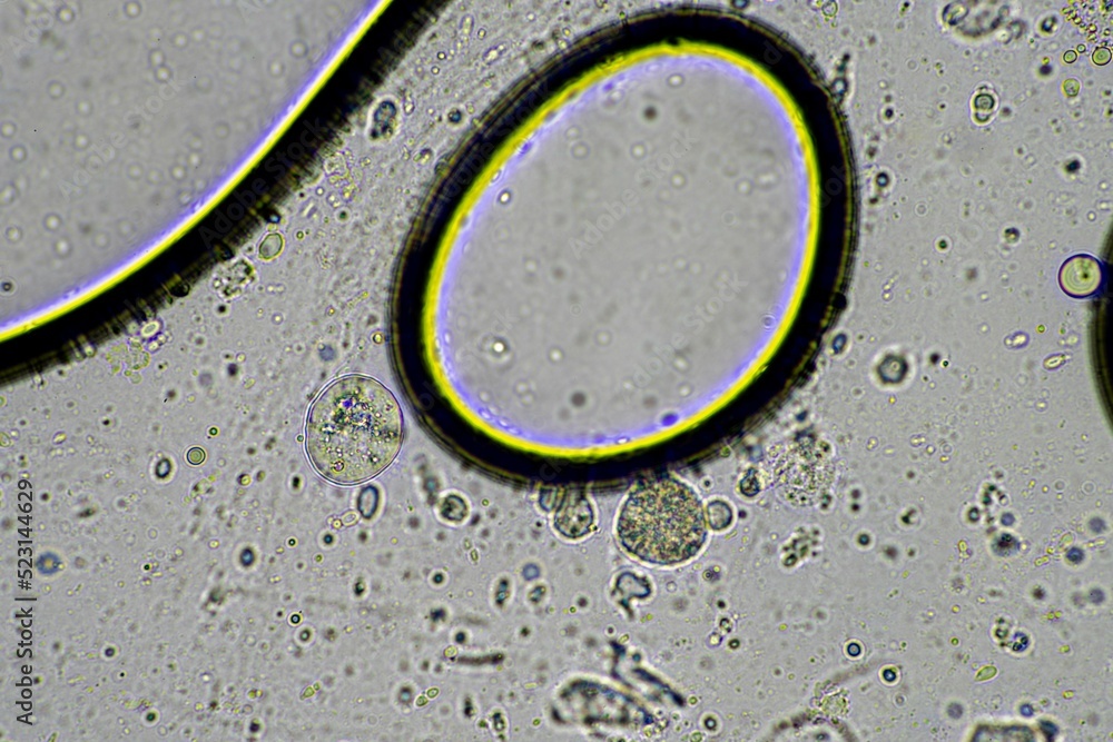 Photo Stock Coughing up mucus and phlegm from a chest infection from a ...