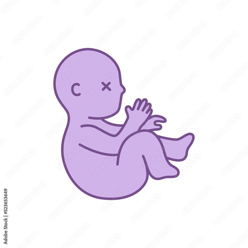 Dead fetus baby vector illustration. Concept miscarriage pregnancy ...