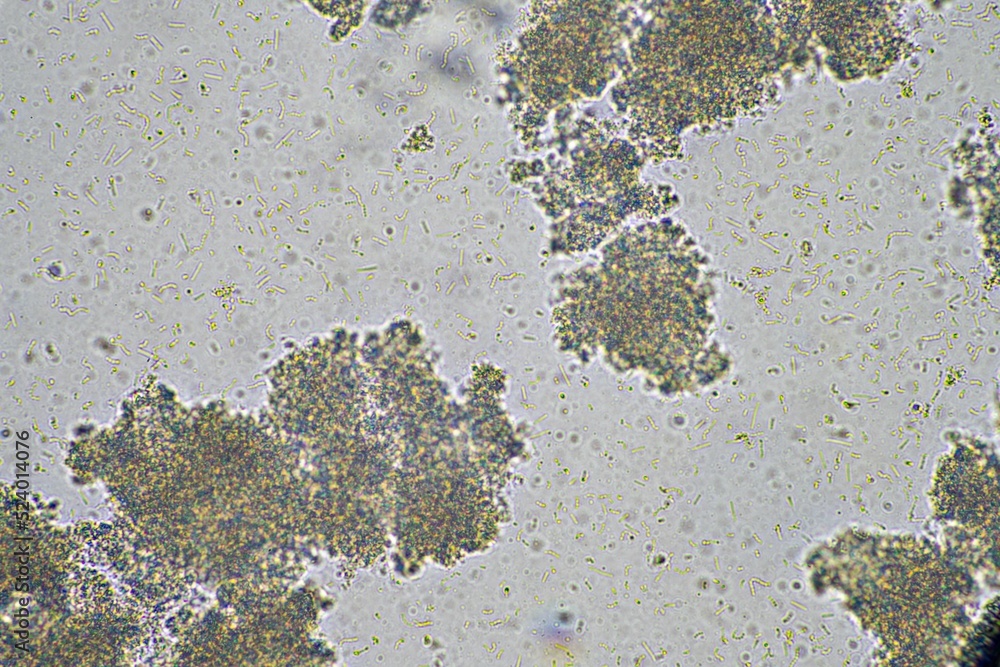 Yogurt under the microscope. Looking at lactobacillus bacteria in a ...