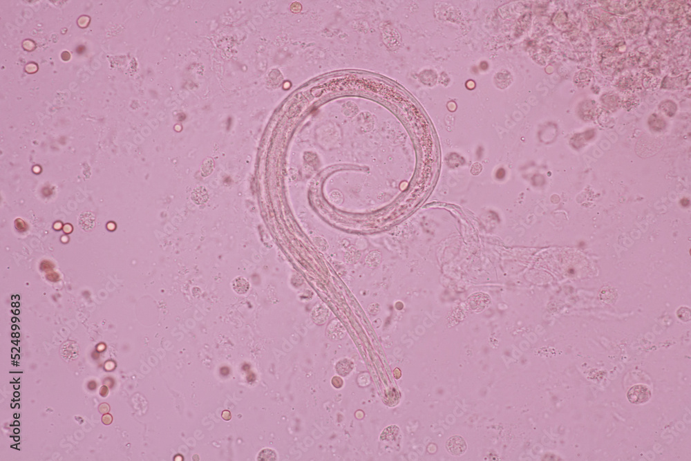 View in microscopic Strongyloides stercoralis or threadworm in human ...
