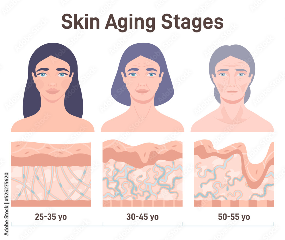 Aging process. Face skin structure changes. cross section diagram ...