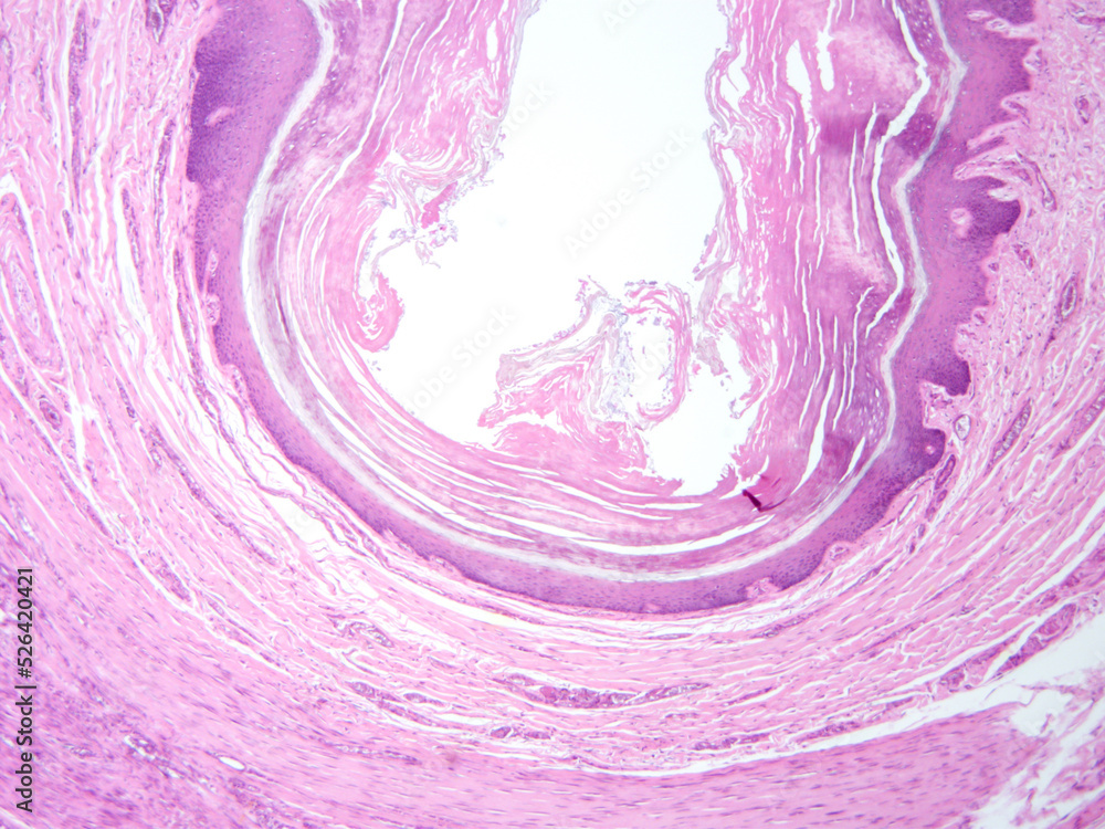 Histology of human tissue, show epithelial tissue and connective tissue ...