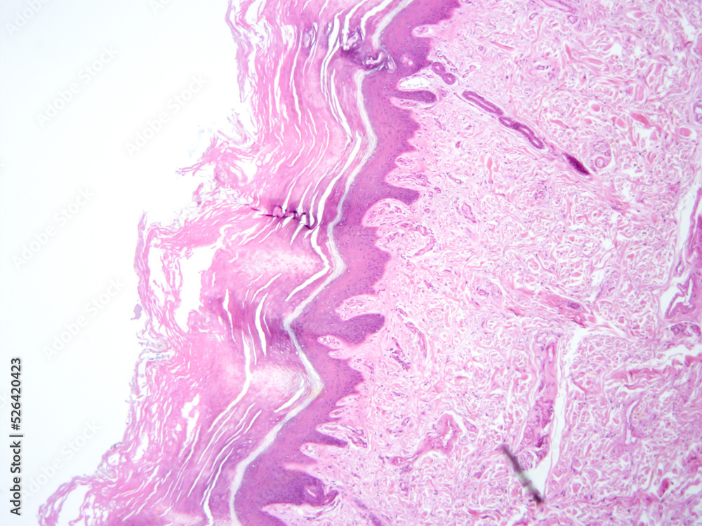 Histology of human tissue, show epithelial tissue and connective tissue ...