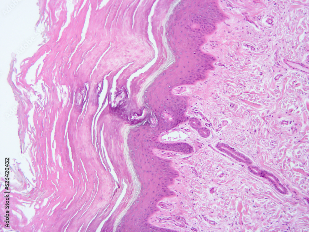 Histology of human tissue, show epithelial tissue and connective tissue ...