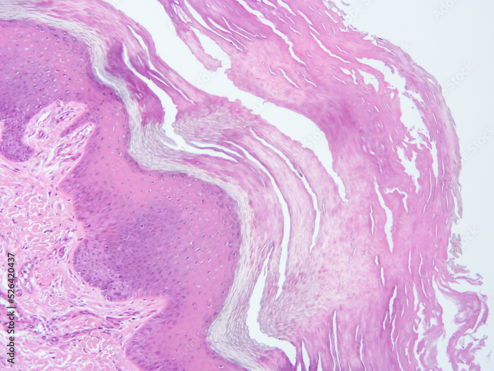 Histology of human tissue, show epithelial tissue and connective tissue ...