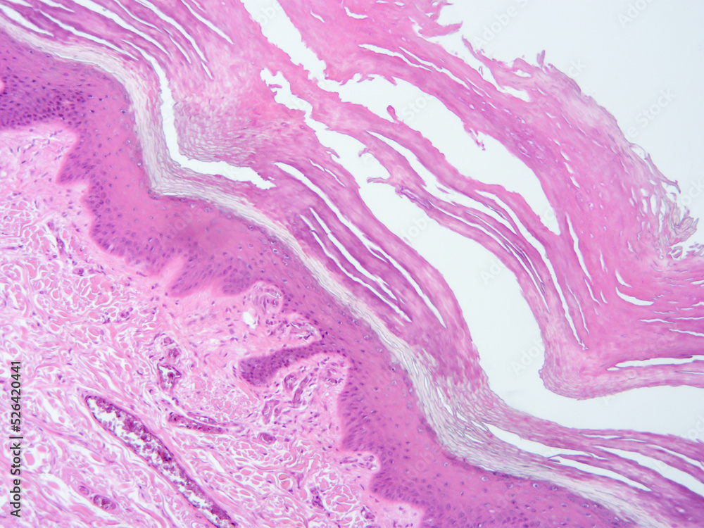 Histology of human tissue, show epithelial tissue and connective tissue ...