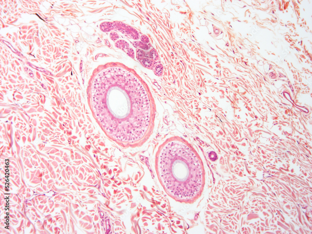 Histology of human tissue, show epithelial tissue and connective tissue ...