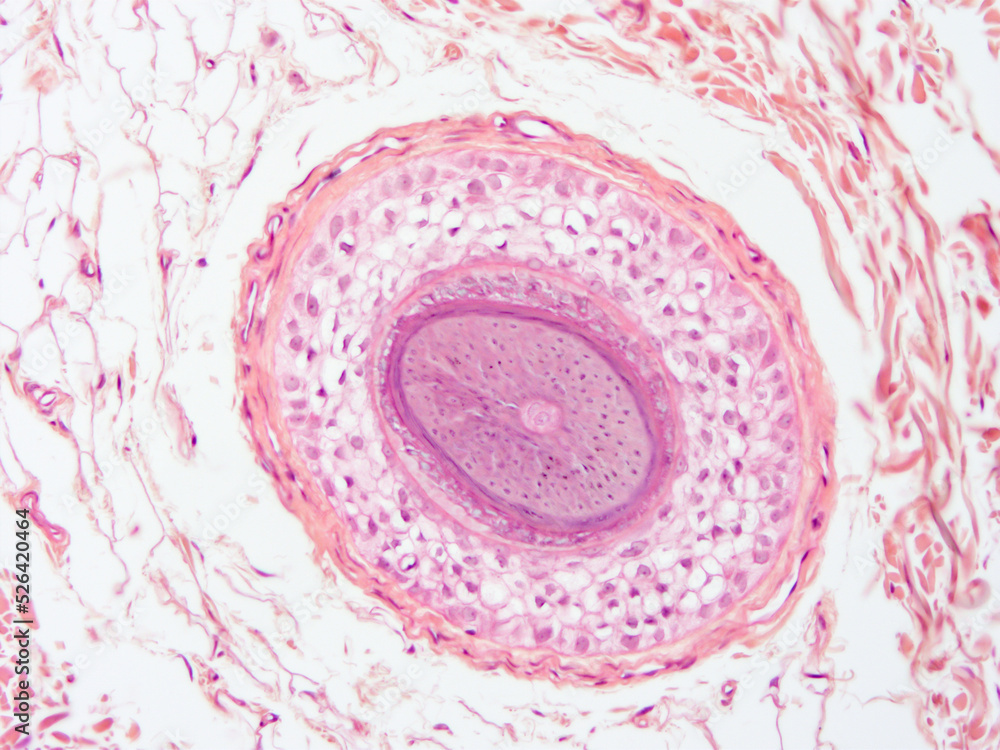 Histology of human tissue, show epithelial tissue and connective tissue ...