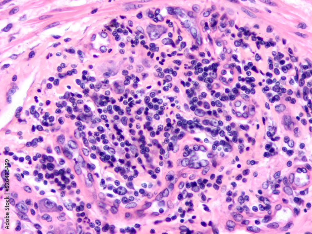 Histology of human tissue, show epithelial tissue and connective tissue ...