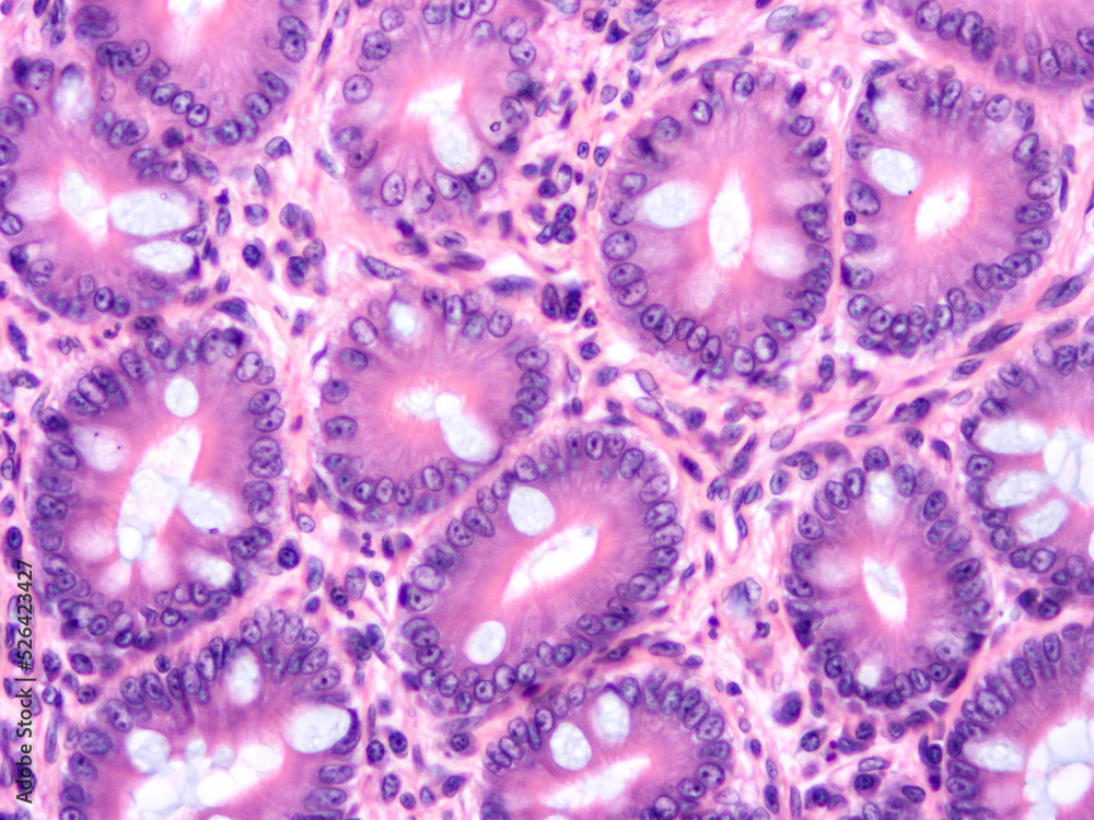 Histology of human tissue, show epithelial tissue and connective tissue ...