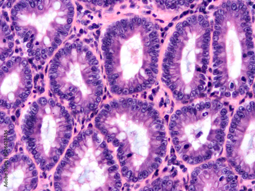 Histology of human tissue, show epithelial tissue and connective tissue ...