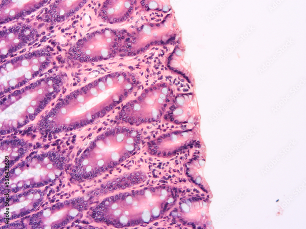 Histology of human tissue, show epithelial tissue and connective tissue ...