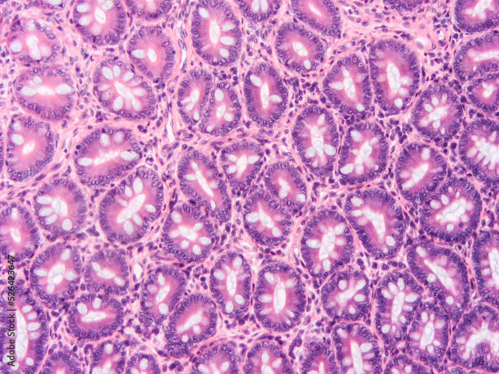 Histology of human tissue, show epithelial tissue and connective tissue ...