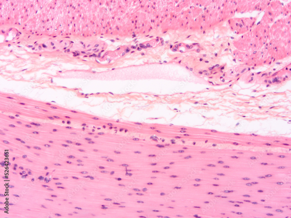 Histology of human tissue, show epithelial tissue and connective tissue ...