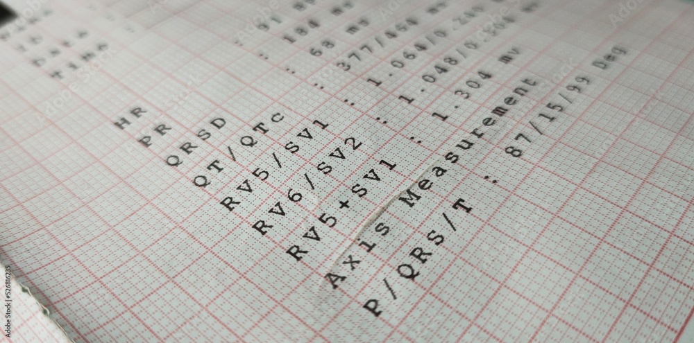 Heart beat rate frequency and rhythm test medical and health ...