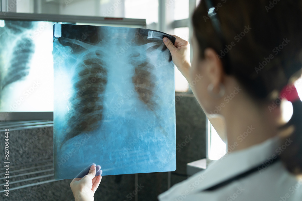 Woman radiology doctor examining chest x-ray film of patient in health ...