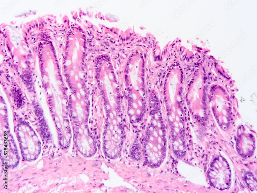 Histology of human tissue, show epithelial tissue and connective tissue ...