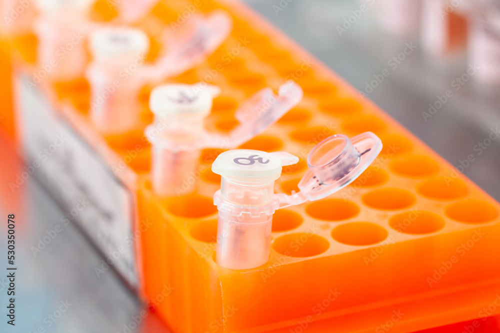 Rack of test tubes being used for DNA extraction using the spin column ...