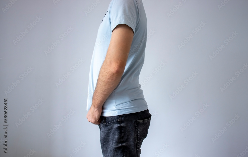 Man with a spinal curvature problem in the lower back hyperlordosis ...