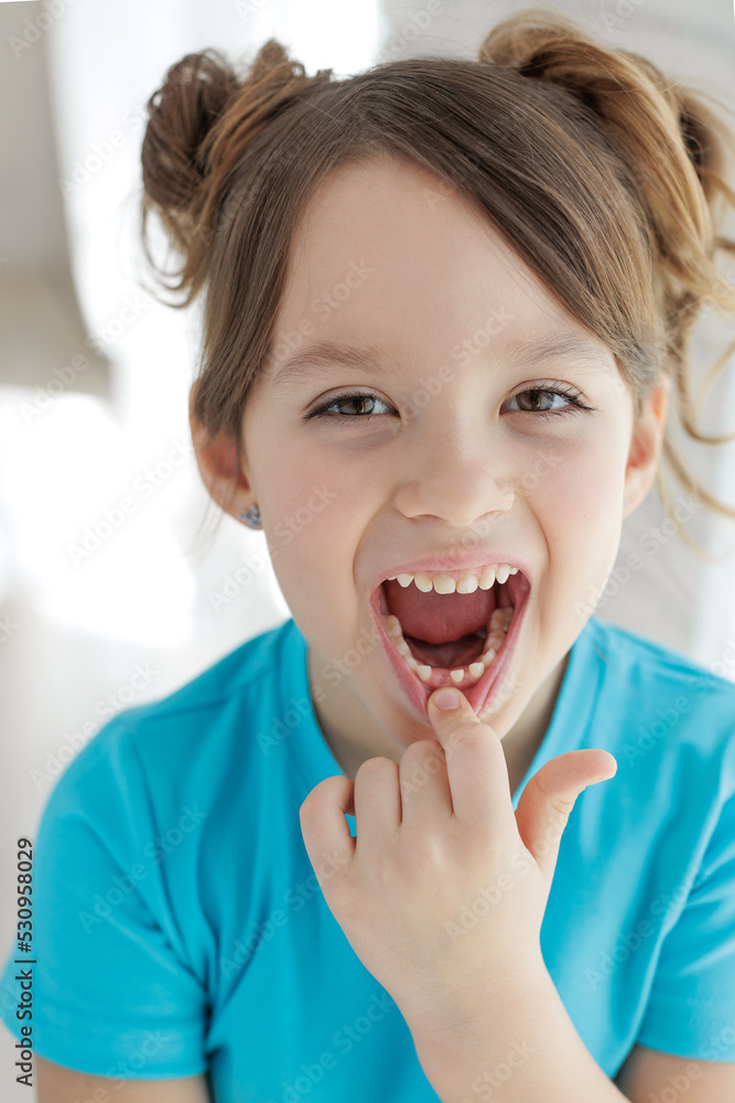 The child has lost a tooth. Little girl without a tooth. The first ...