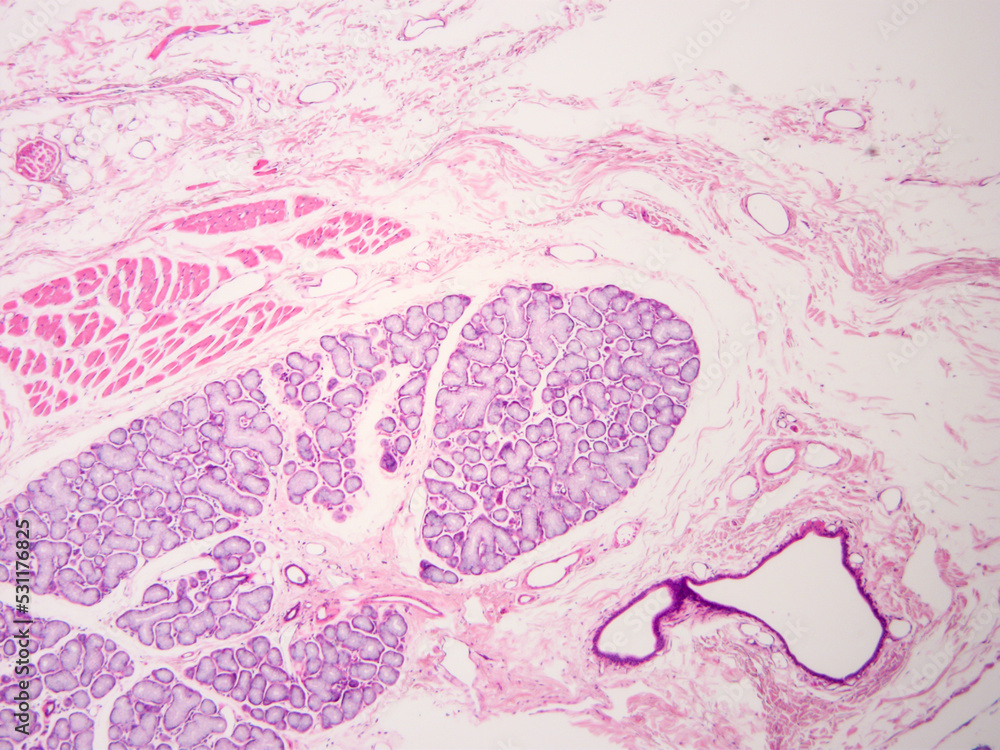 Histology of human tissue, show epithelial tissue and connective tissue ...