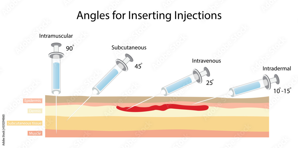 Stock-Vektorgrafik „illustration of biology and medical, Angles for ...