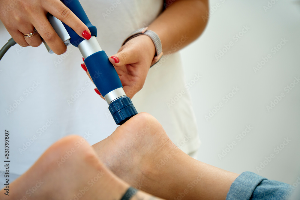 Extracorporeal Shockwave Therapy (ESWT). Effective treatment for ...