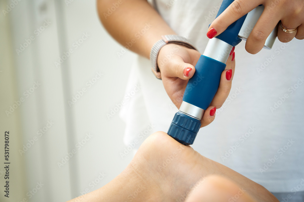 Extracorporeal Shockwave Therapy (ESWT). Effective treatment for ...